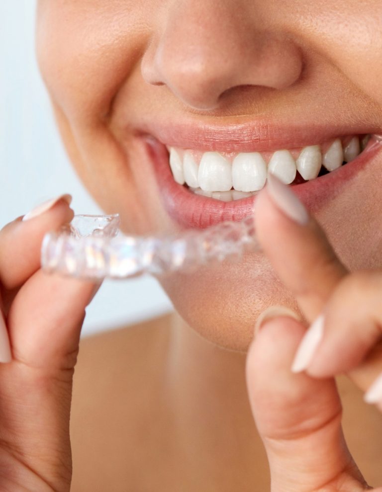 Orthodontic Treatment Options: Braces | Clear Aligners | Expanders